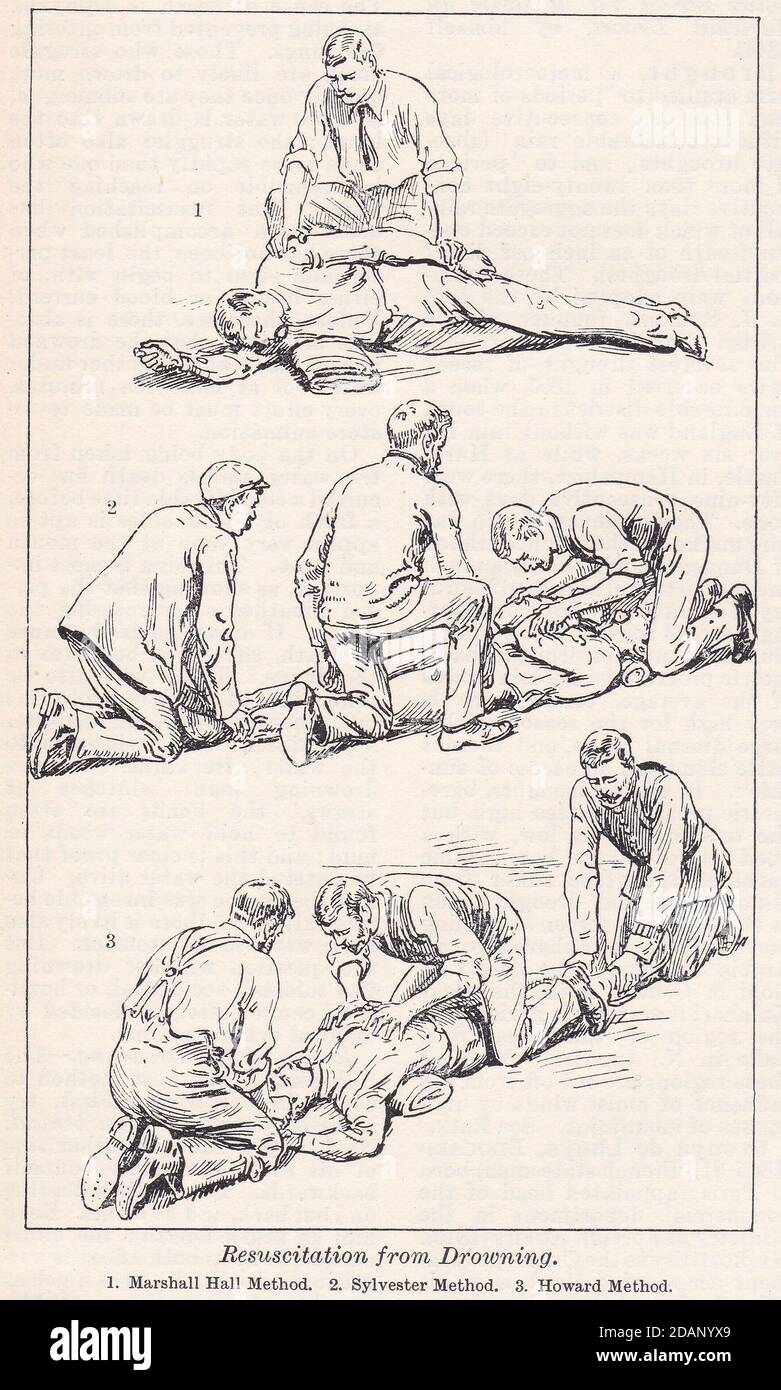 Sylvester method hi-res stock photography and images - Alamy