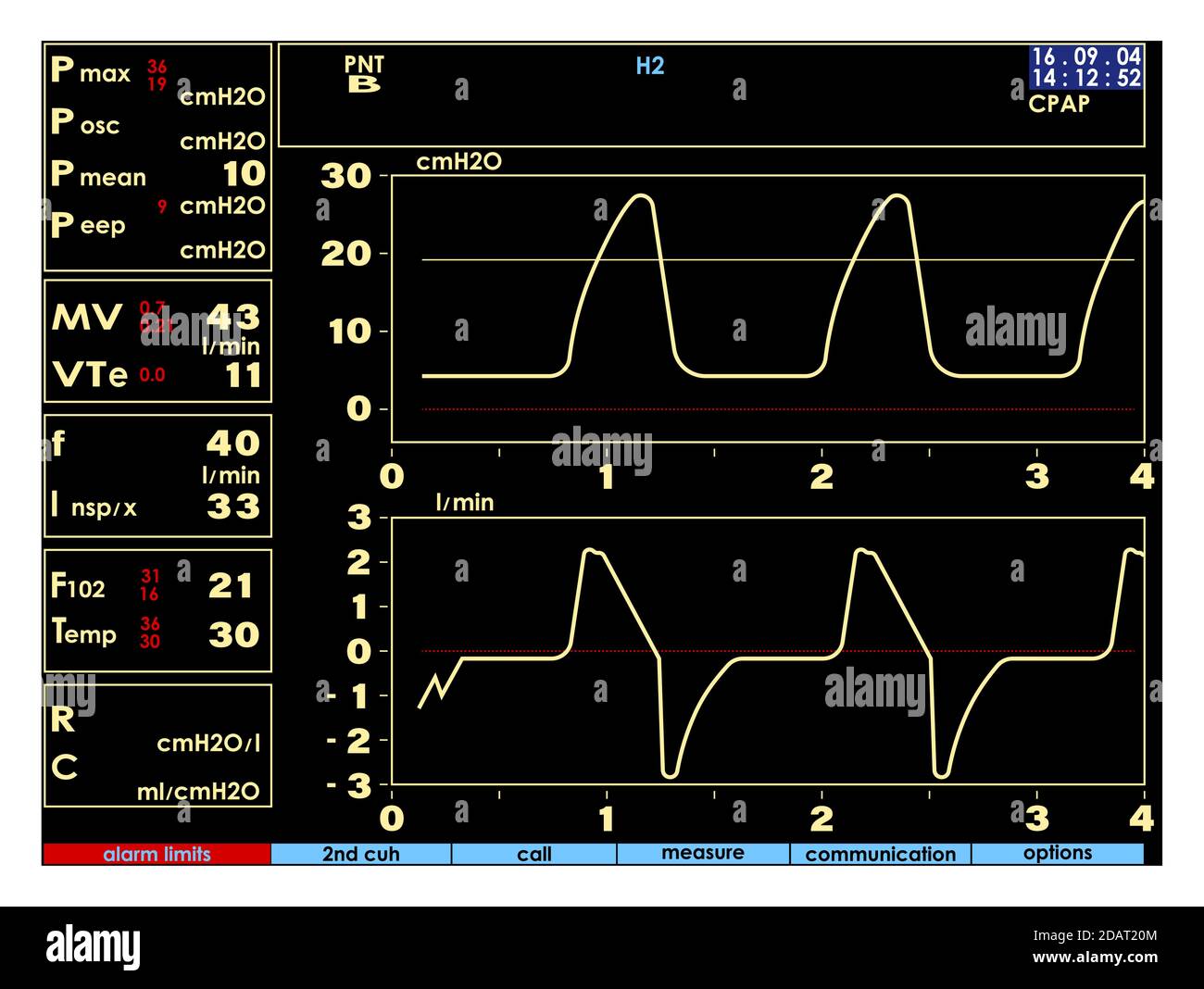 Screen, monitor with signs of the artificial lung ventilation device in ...