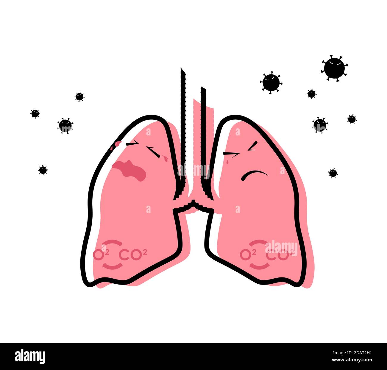 Pneumonia lung drawing Cut Out Stock Images & Pictures - Alamy