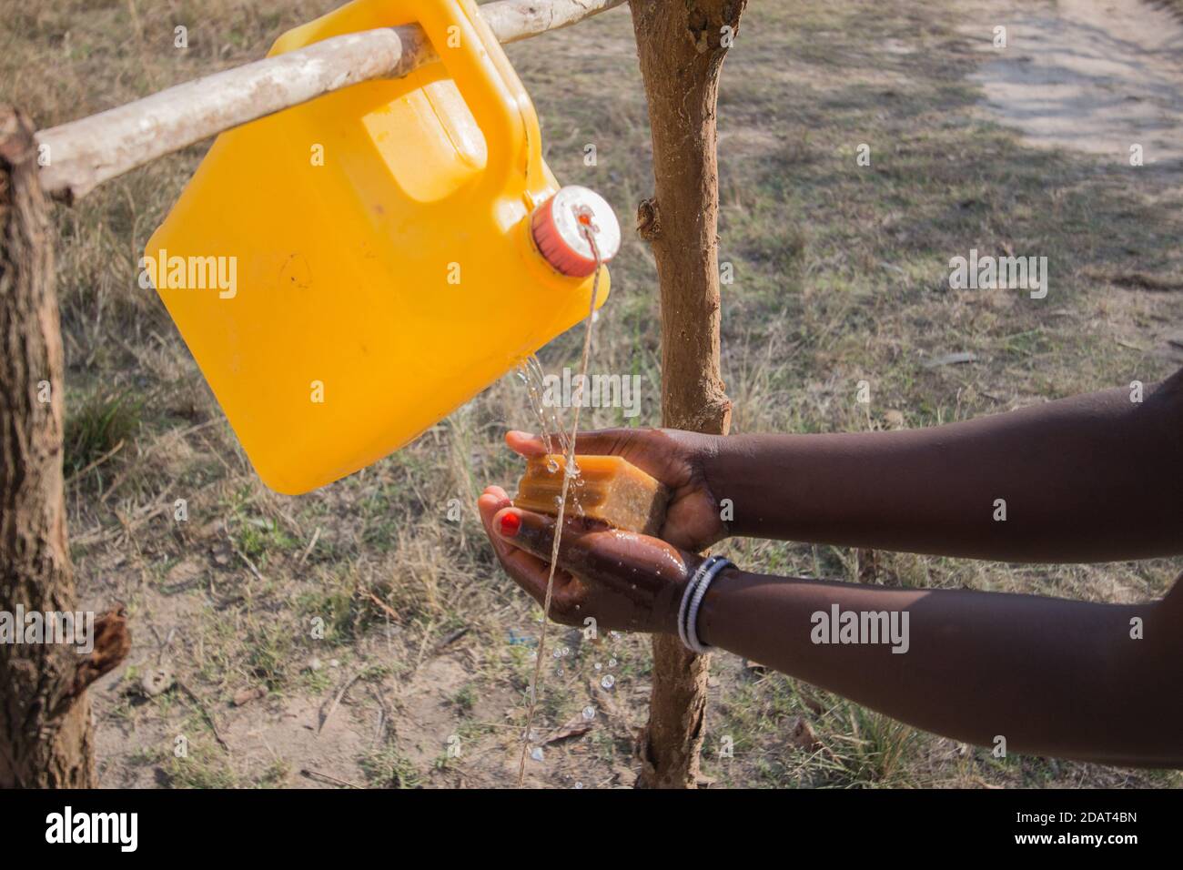 Hand washing using african soap bar. And the innovation called tippy ...