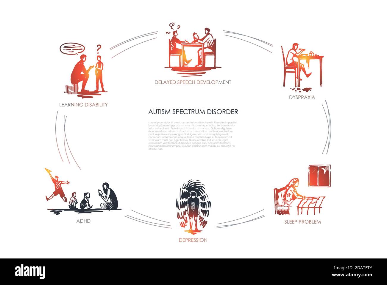 Autism spectrum disorder - delayed speech development, dyspraxia, sleep ...