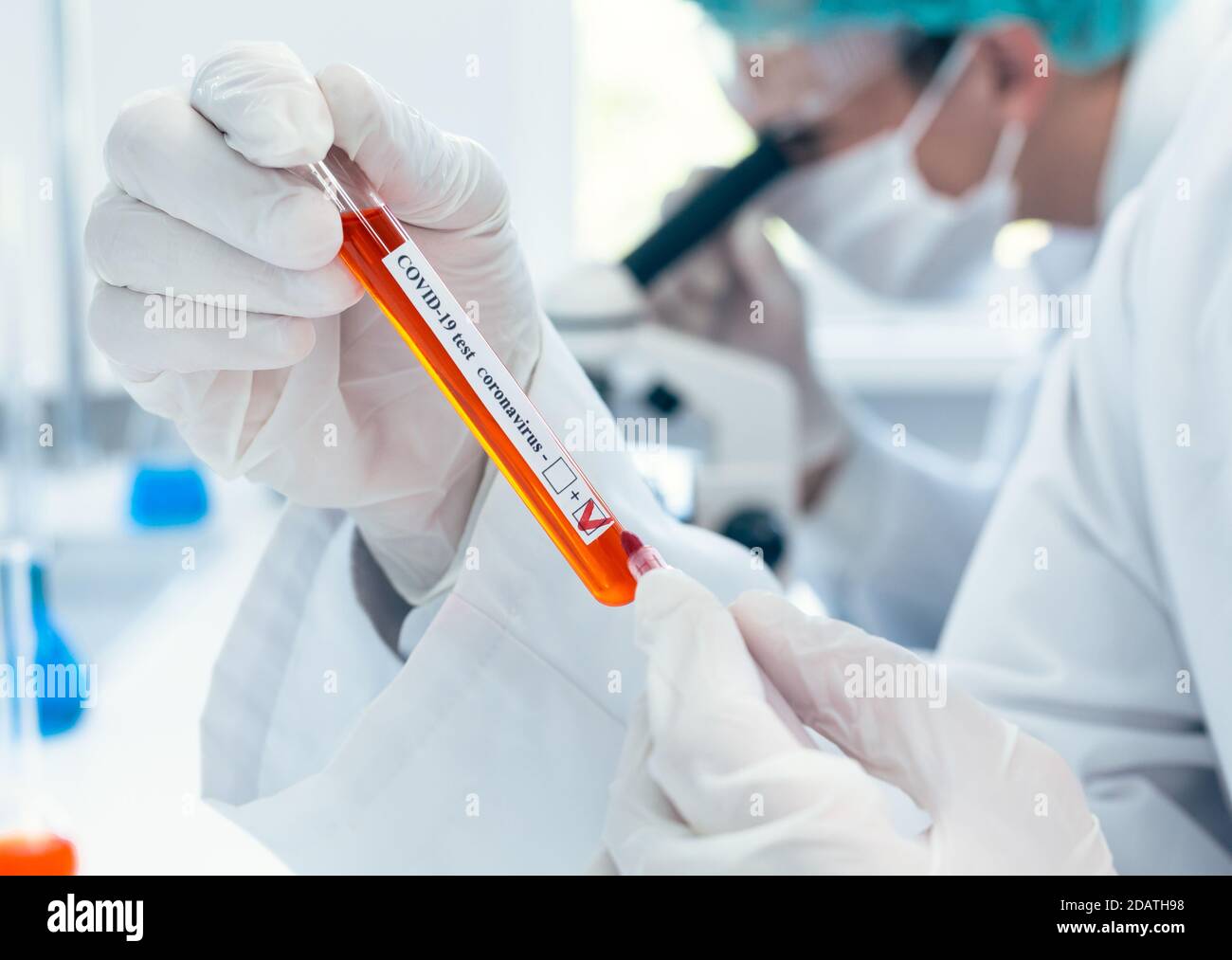 close up. lab technician making a mark on the tube with the test Stock ...
