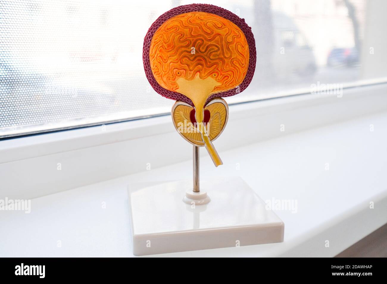 Plastic bladder in the doctor's office. Visual material for the ...