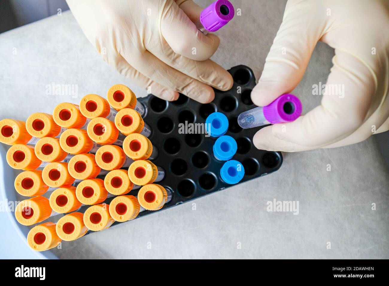 Nurse work with test tubes. Top view, hands in gloves, colored tubes ...