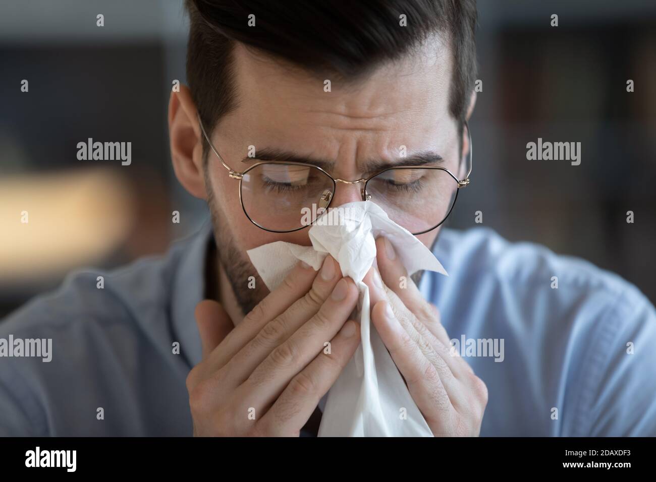 Chronic sinusitis hi-res stock photography and images - Alamy
