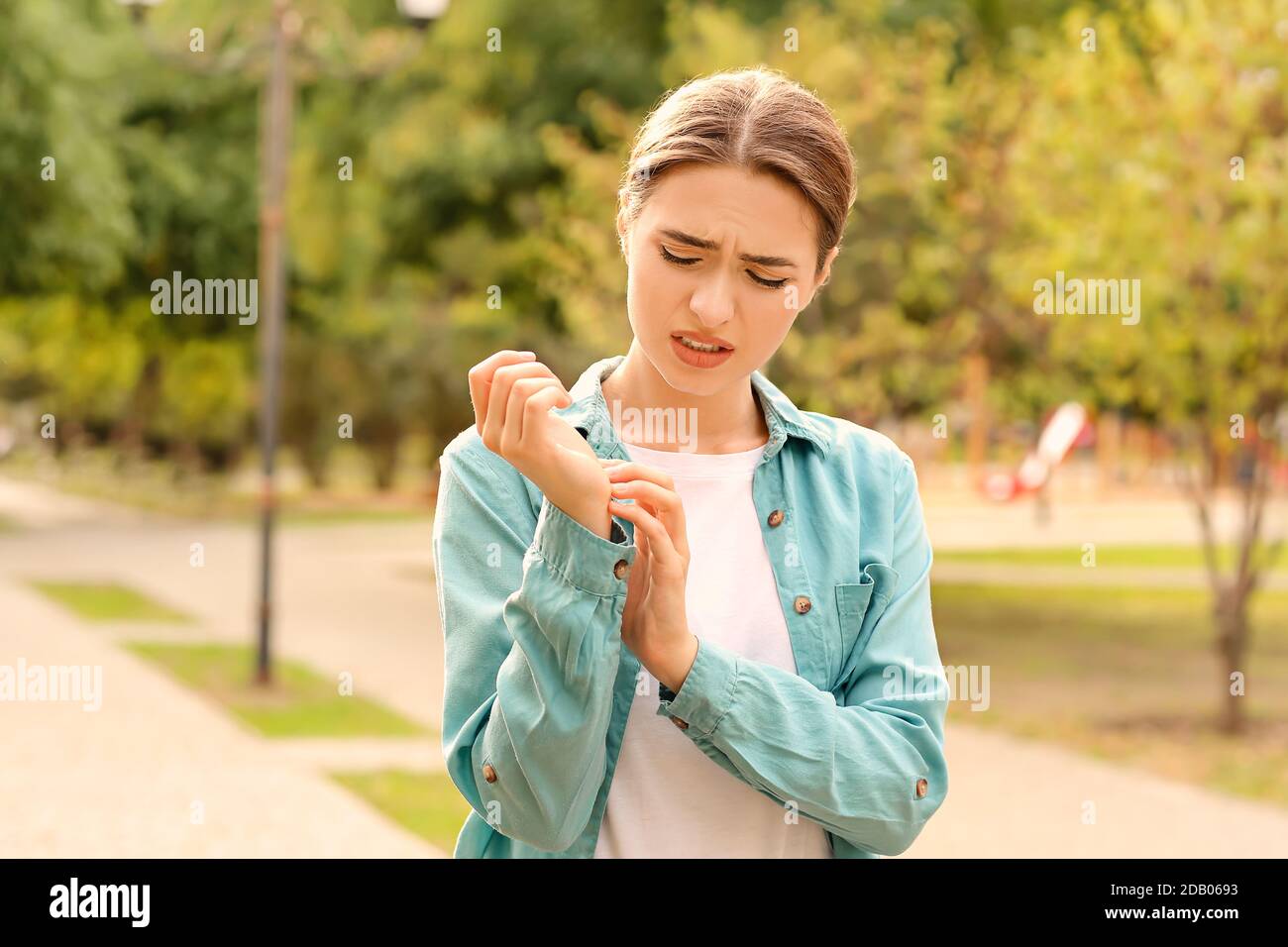 Allergic young woman scratching herself outdoors Stock Photo - Alamy