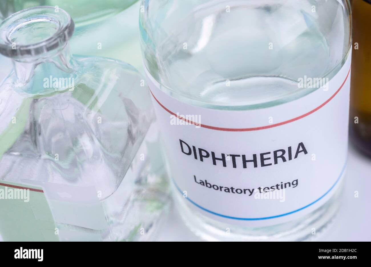 Test diphtheria in laboratory, conceptual image, composition horizontal ...