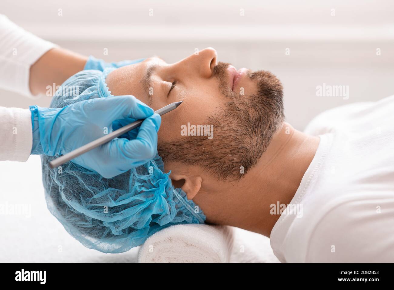 Man face surgery marks hi-res stock photography and images - Alamy