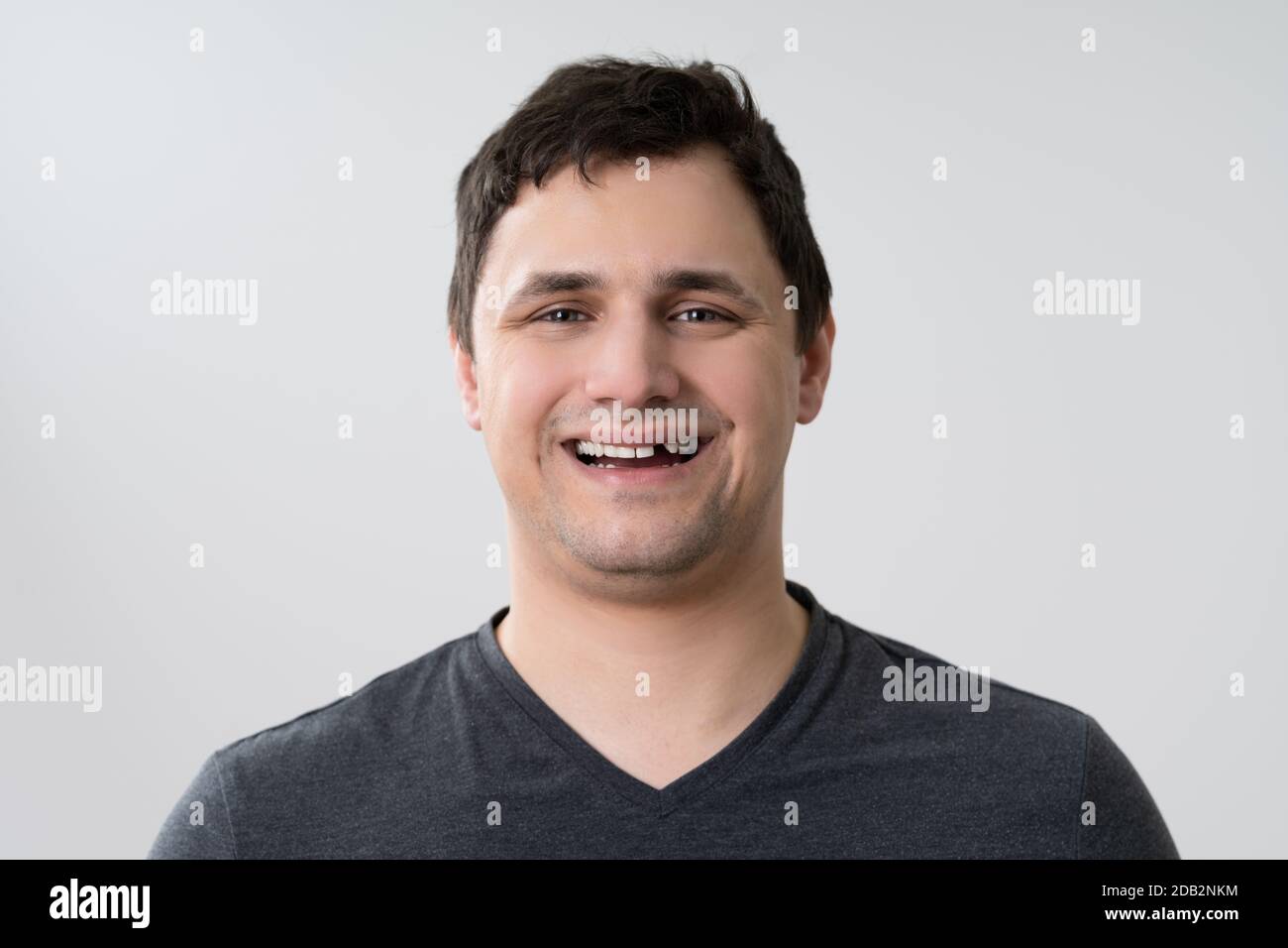 Smile close adult tooth missing hi-res stock photography and images - Alamy