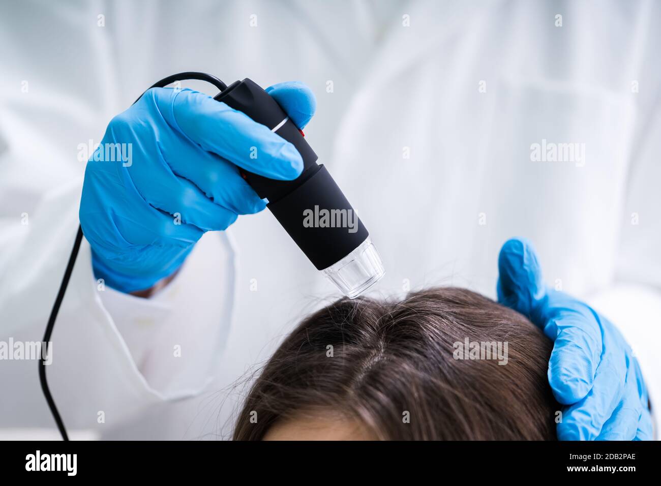 Close-up Of Dermatologist Using Trichoscope For Hair Fall Treatment His ...