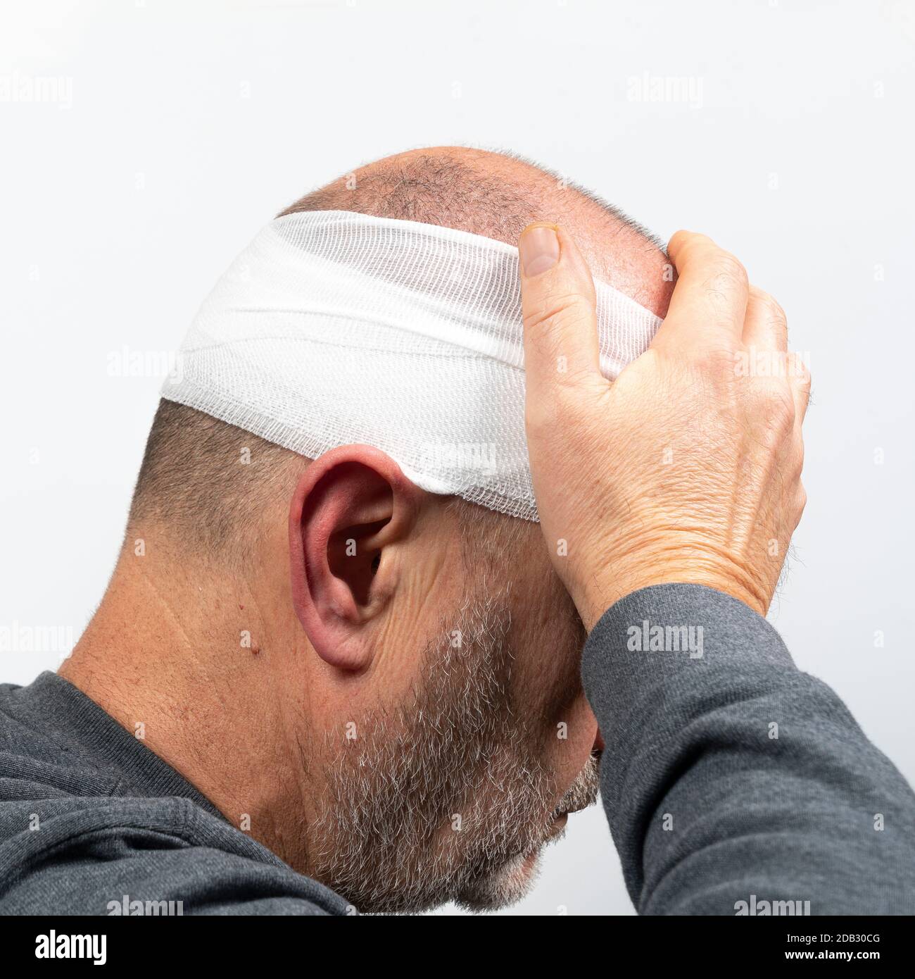 A middle-aged man with a bandaged head Stock Photo - Alamy