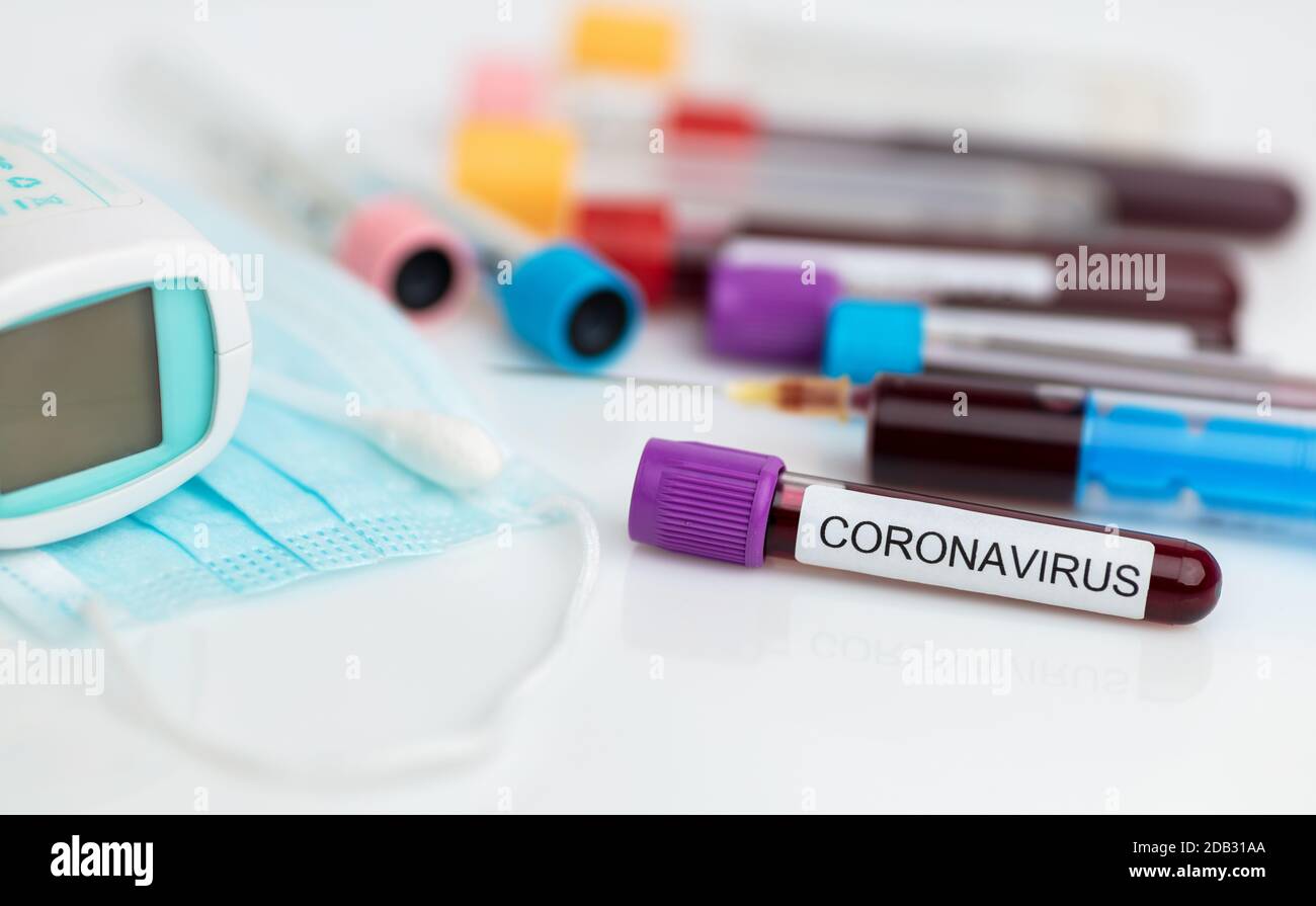 Testing the laboratory sample of the novel Coronavirus Stock Photo - Alamy