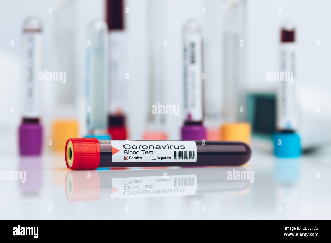 Testing the laboratory sample of the novel Coronavirus Stock Photo - Alamy
