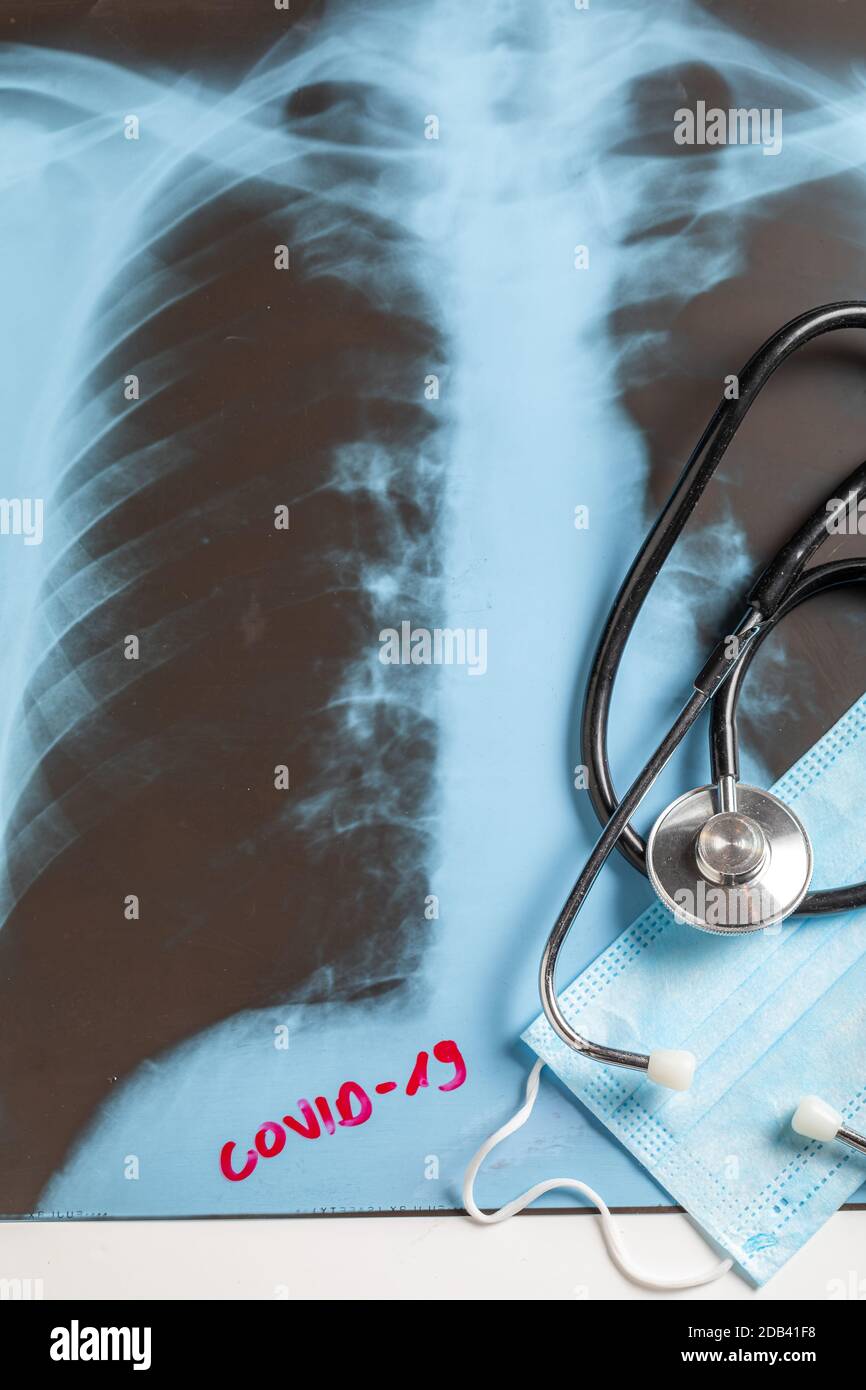 Sick lungs x-ray, protective mask and stethoscope on white background ...
