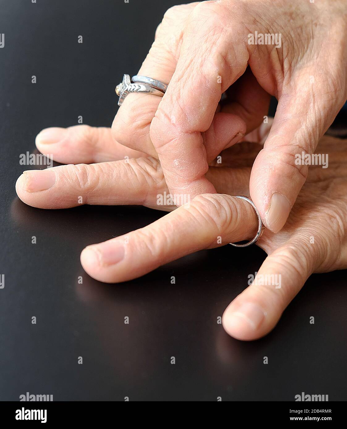 elderly woman's hand with a ring on her finger, old woman's hand and ...