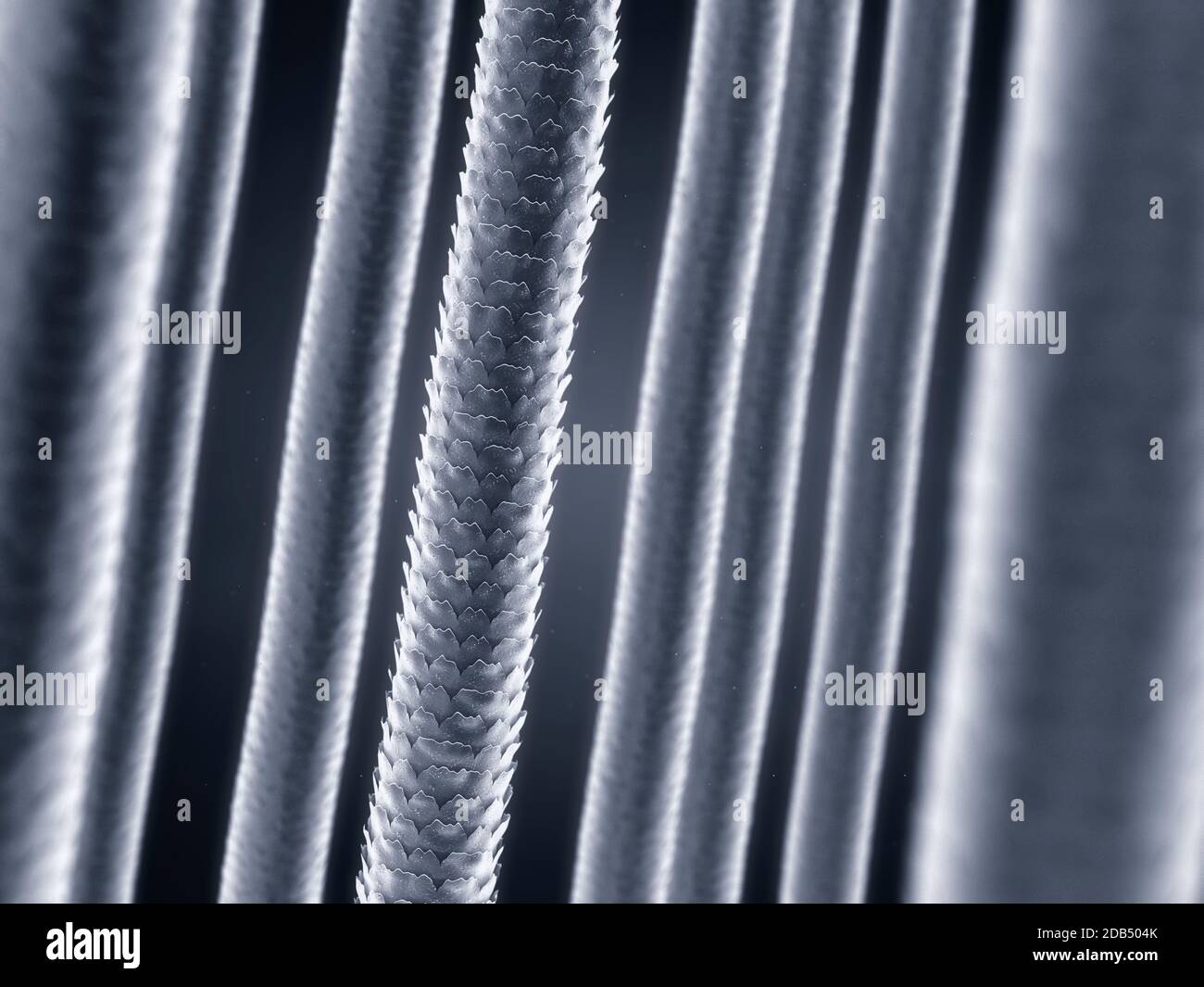 Damaged Human Hair Under Microscope