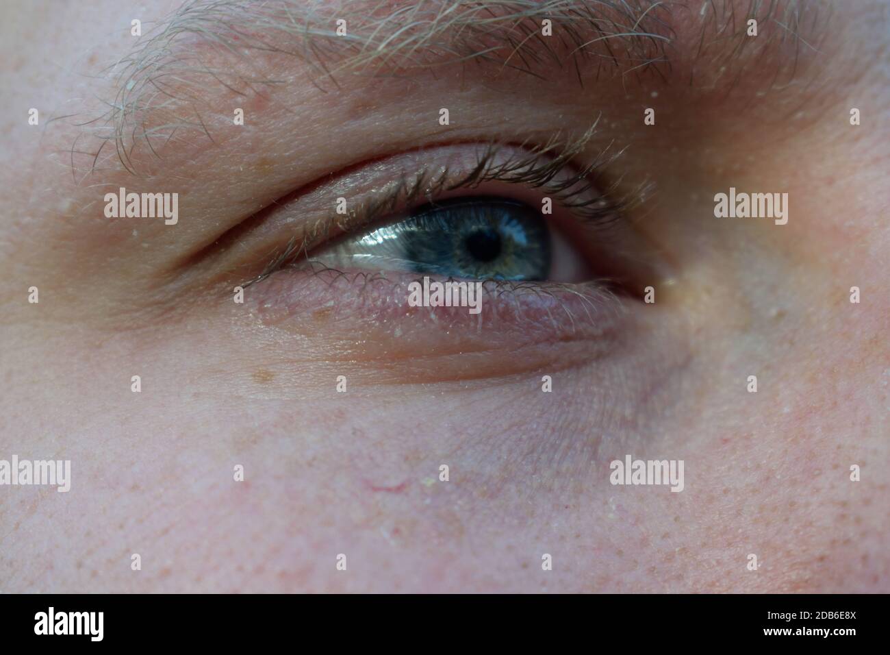 Normal skin close up hi-res stock photography and images - Alamy