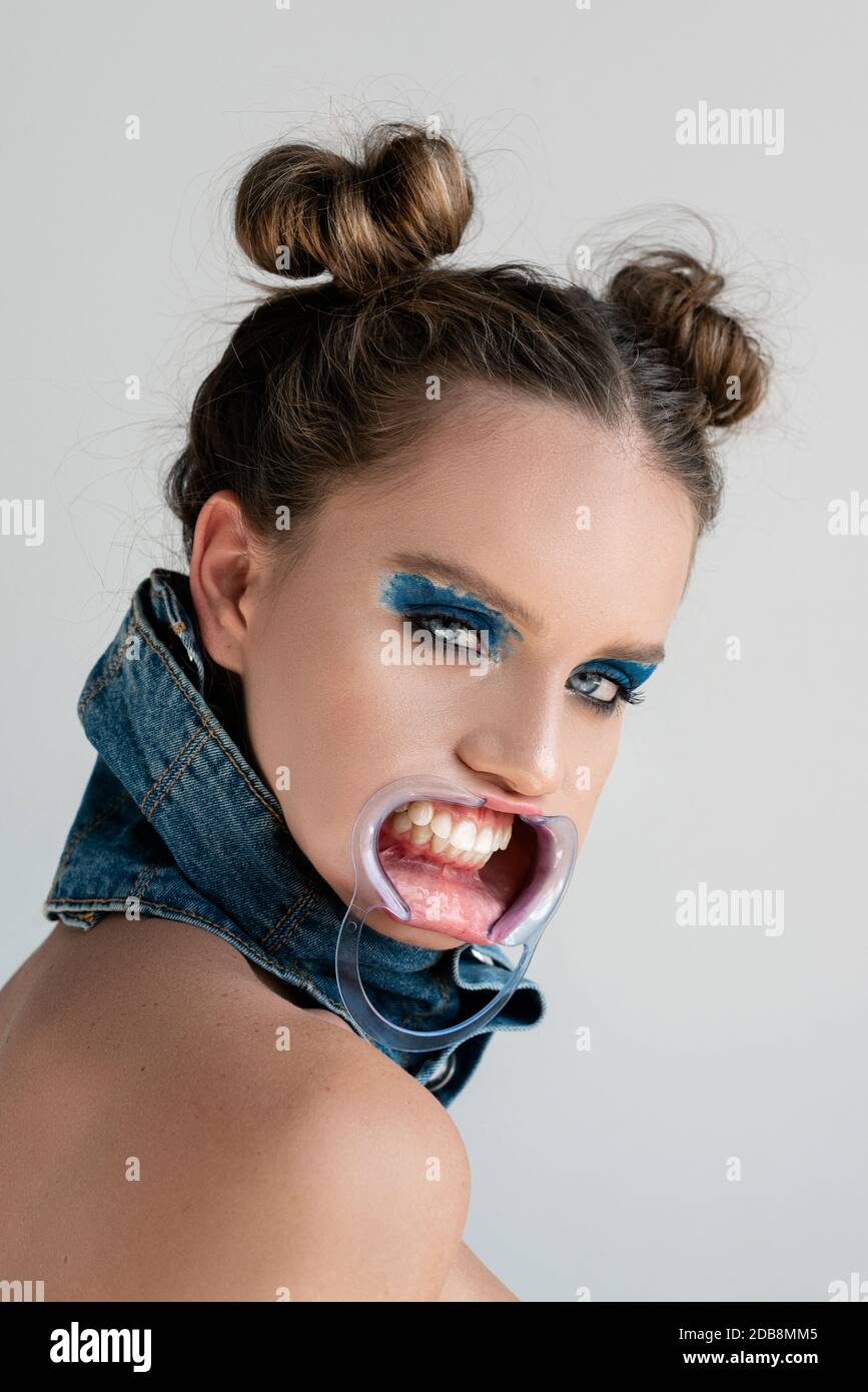 Portrait of a woman wearing a dental mouth retractor Stock Photo - Alamy