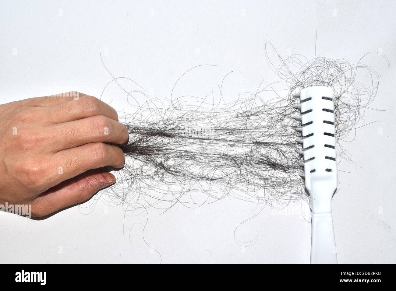 Hair loss problems are many Stock Photo - Alamy