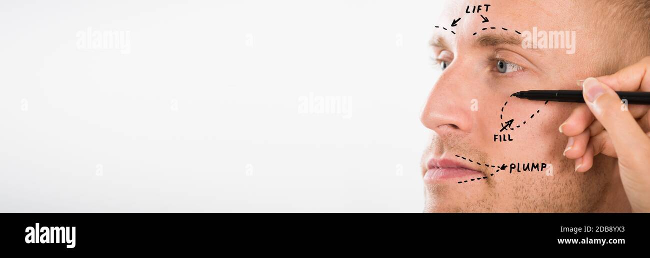 Cosmetic Aesthetic Facial Man Surgery And Liposuction Stock Photo - Alamy