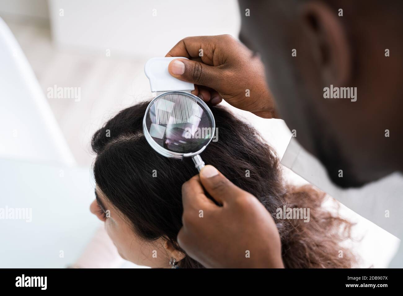 Close-up Of A Dermatologist's Hand Checking Patient's Hair With ...