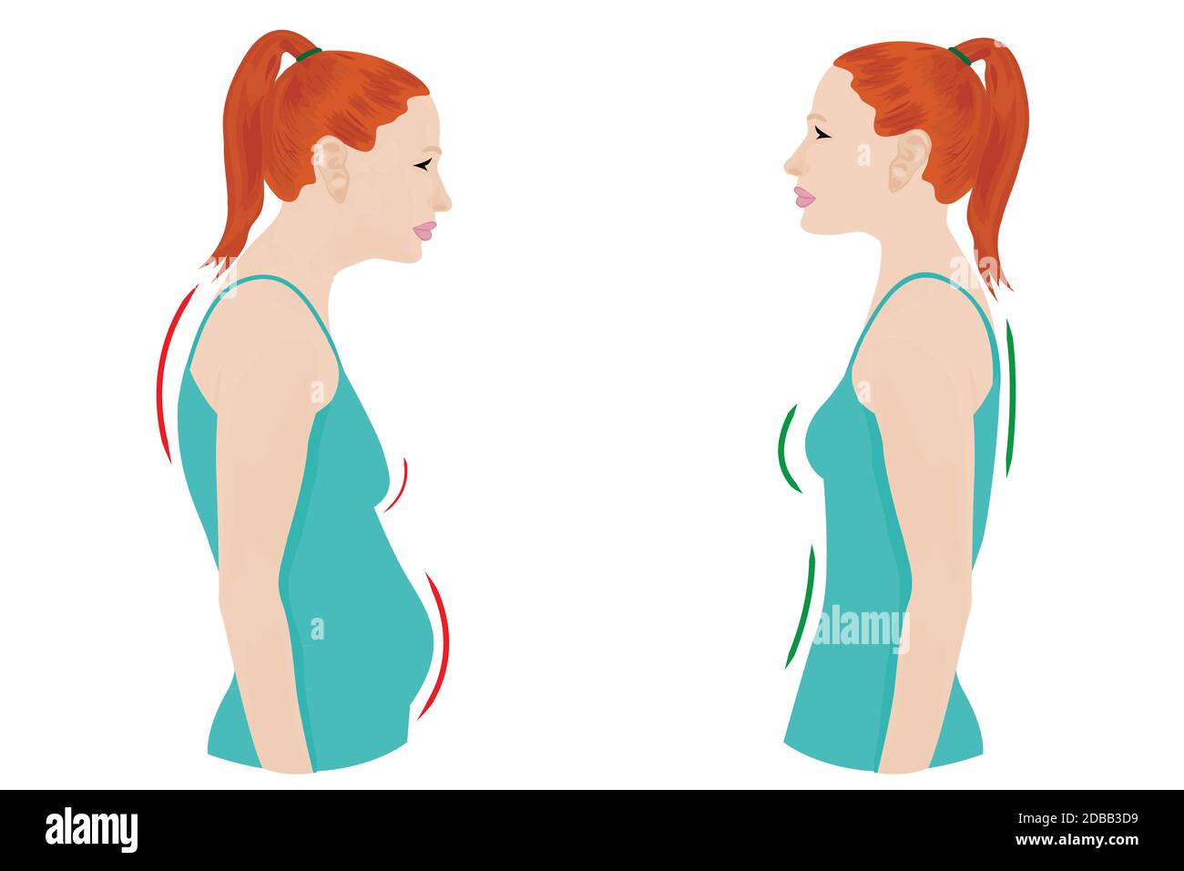 Good and bad posture woman figure vector illustration before and after ...