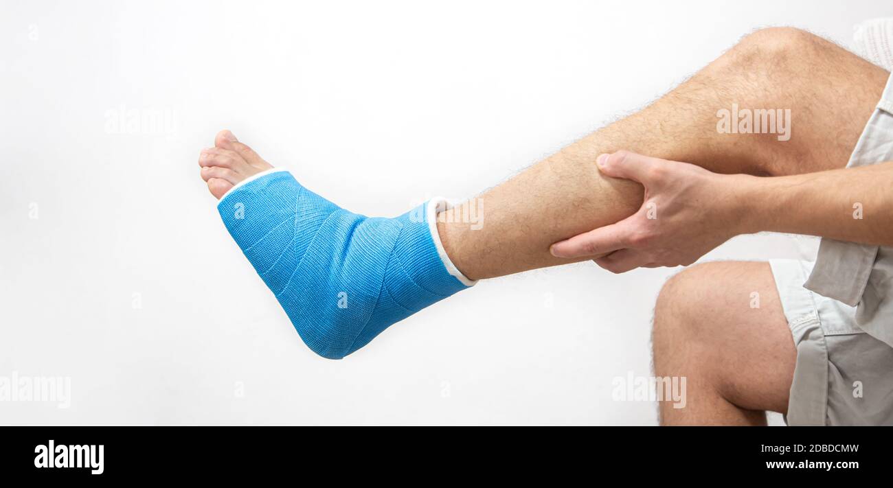 Blue splint ankle. Bandaged leg cast on male patient on white ...