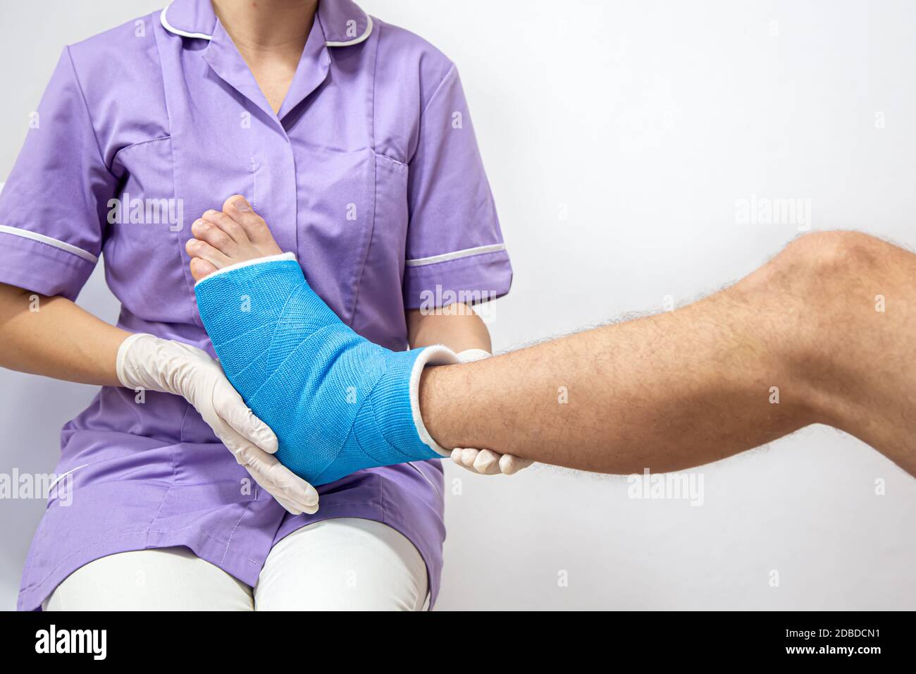 Close up of a man's leg in a cast and a blue splint after bandaging in ...