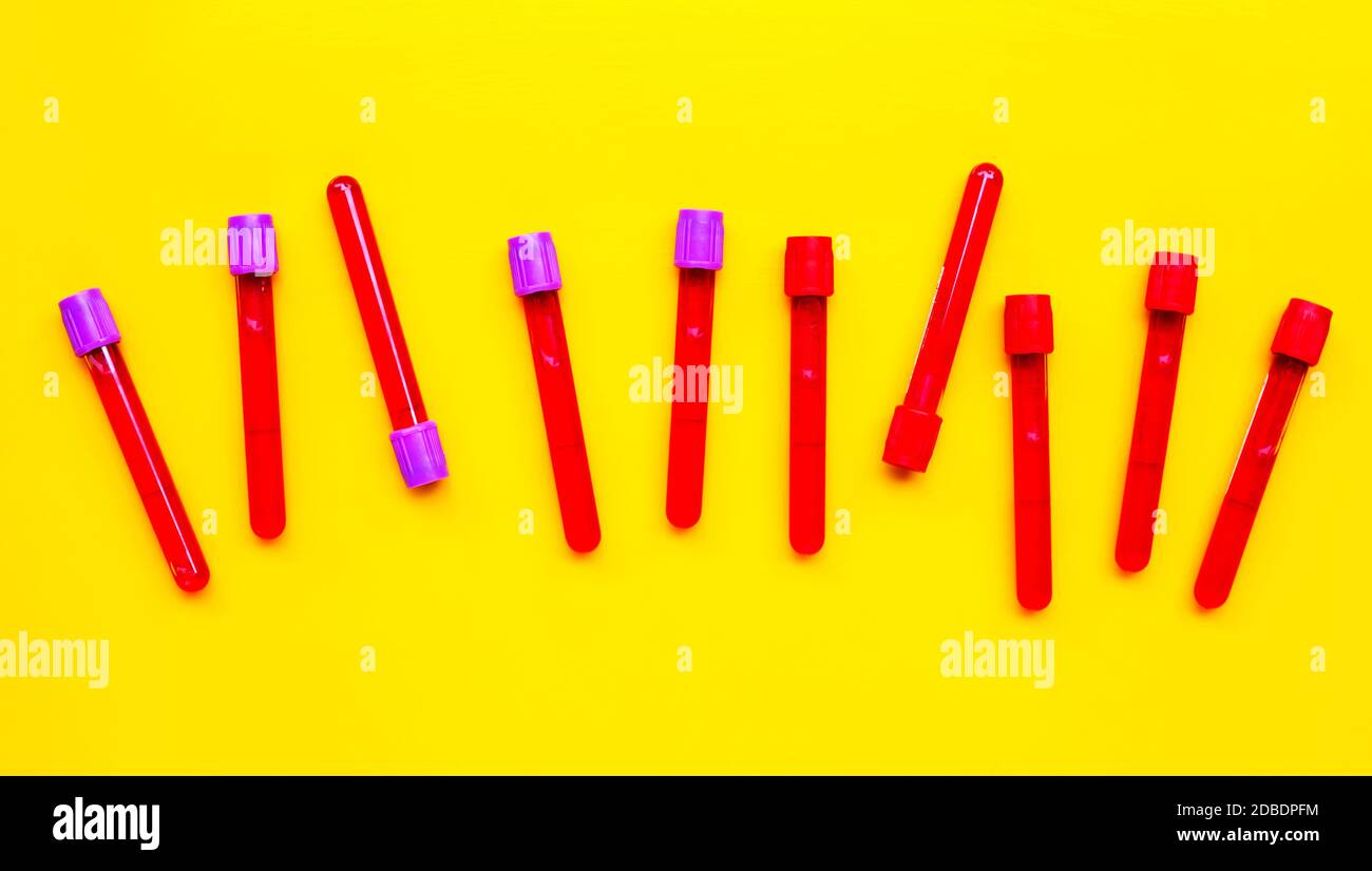 Yellow top blood tubes hi-res stock photography and images - Alamy