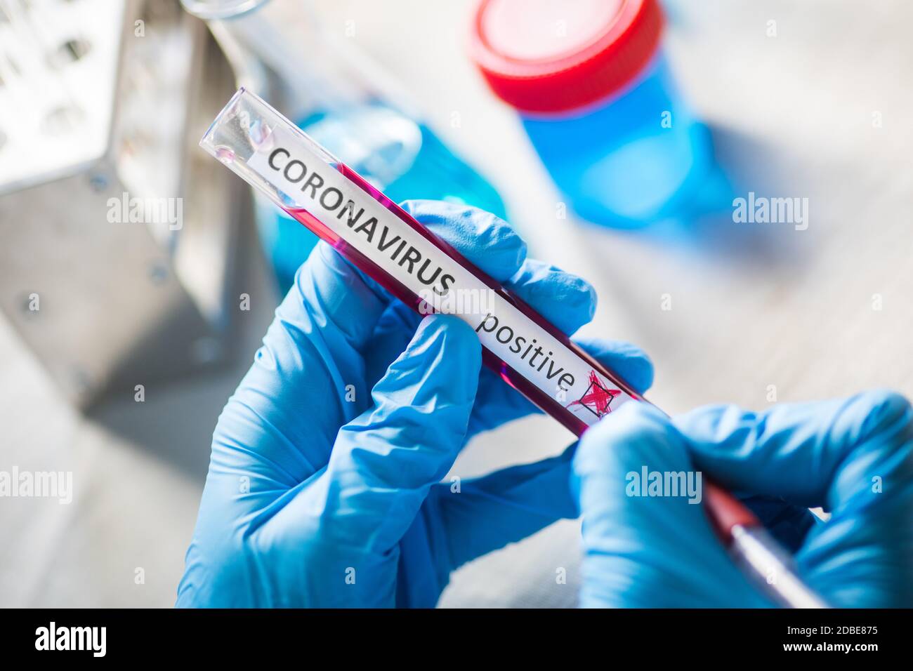 Conceptual photograph of a doctor's hands holding and marking a test ...