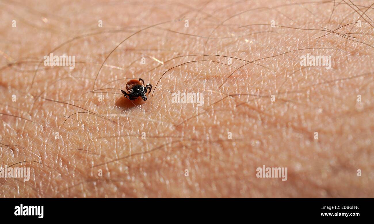 Small tick Ixodes ricinus crawling on human skin Stock Photo - Alamy