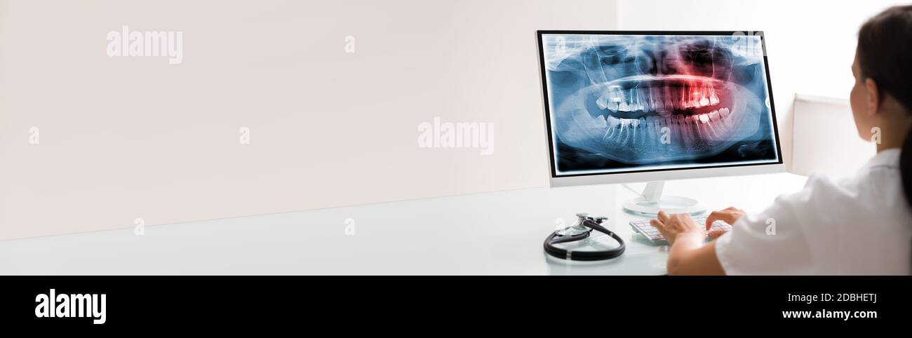 Dentist Using Computer Technology Dental Software For Teeth Xray Stock ...