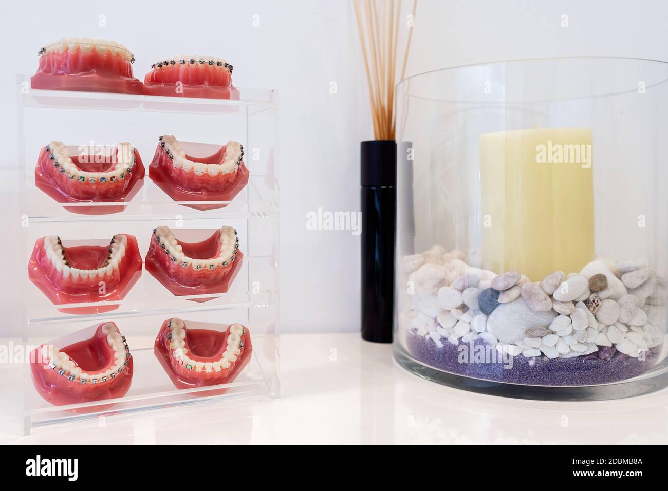 Samples of artificial mouths with brackets on the table of a dental ...