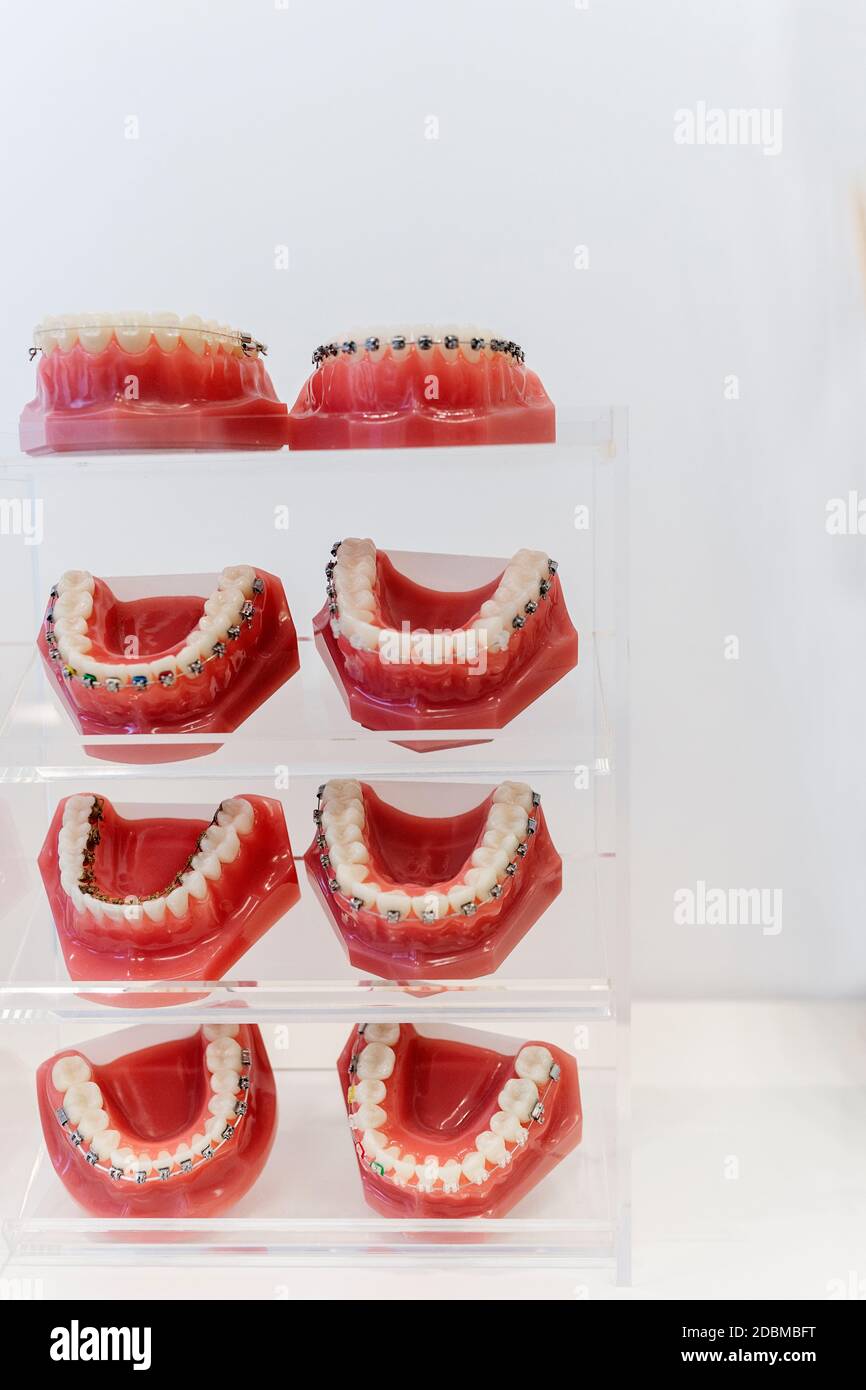 Samples of artificial mouths with brackets on the table of a dental ...