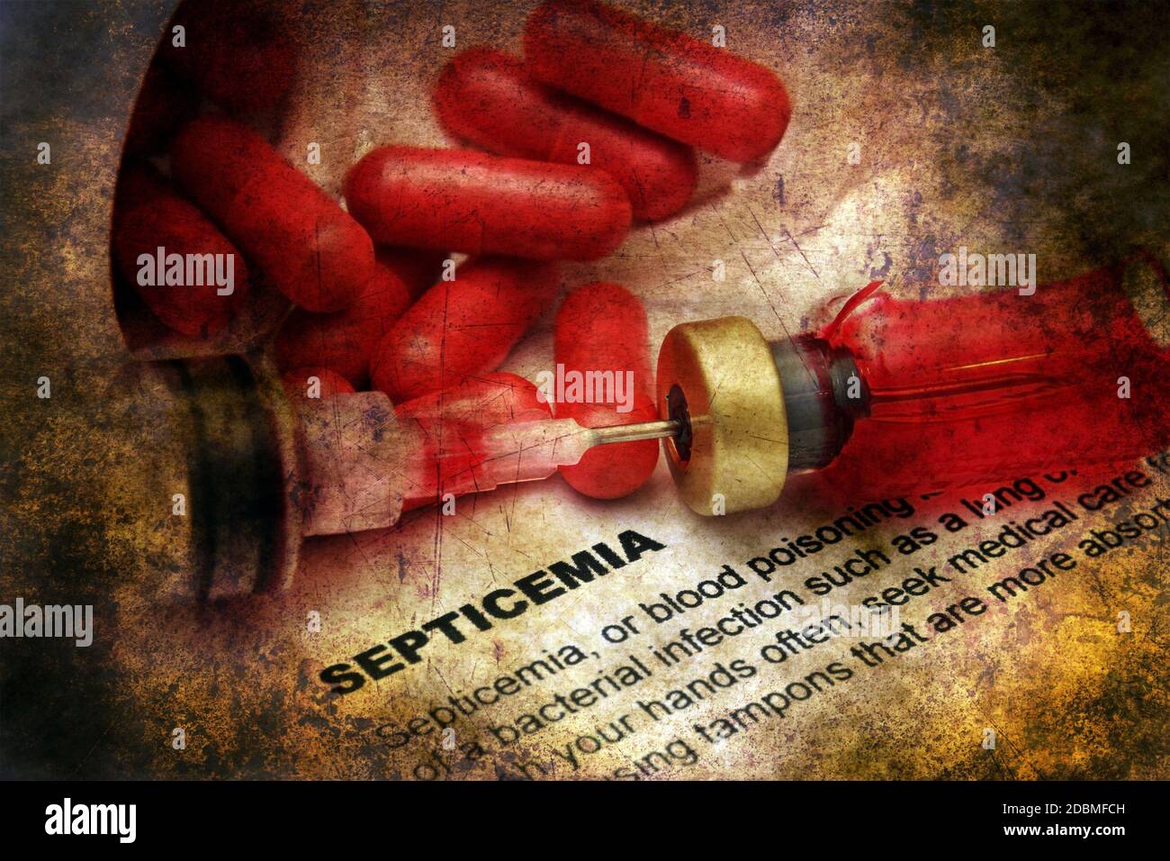 Septicemia hi-res stock photography and images - Alamy