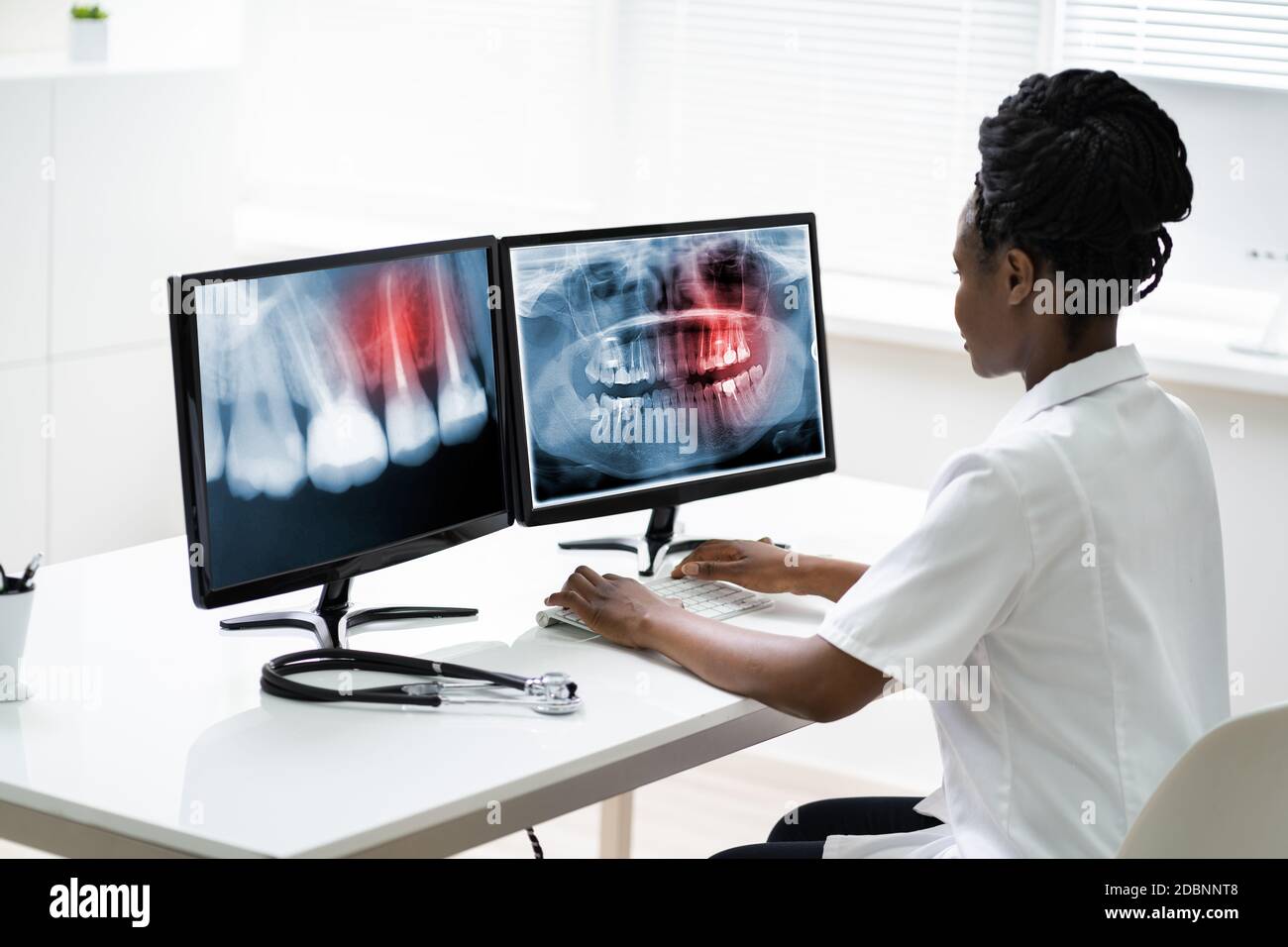 Dentist Doctor Looking At Teeth Xray Using Computer Software Stock ...