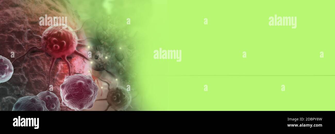 Digital 3d illustration of cancer cells in human body Stock Photo - Alamy