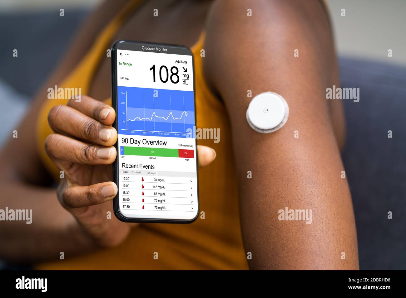 Continuous glucose monitor hi-res stock photography and images - Alamy Continuous glucose monitor hi-res stock photography and images - Alamy