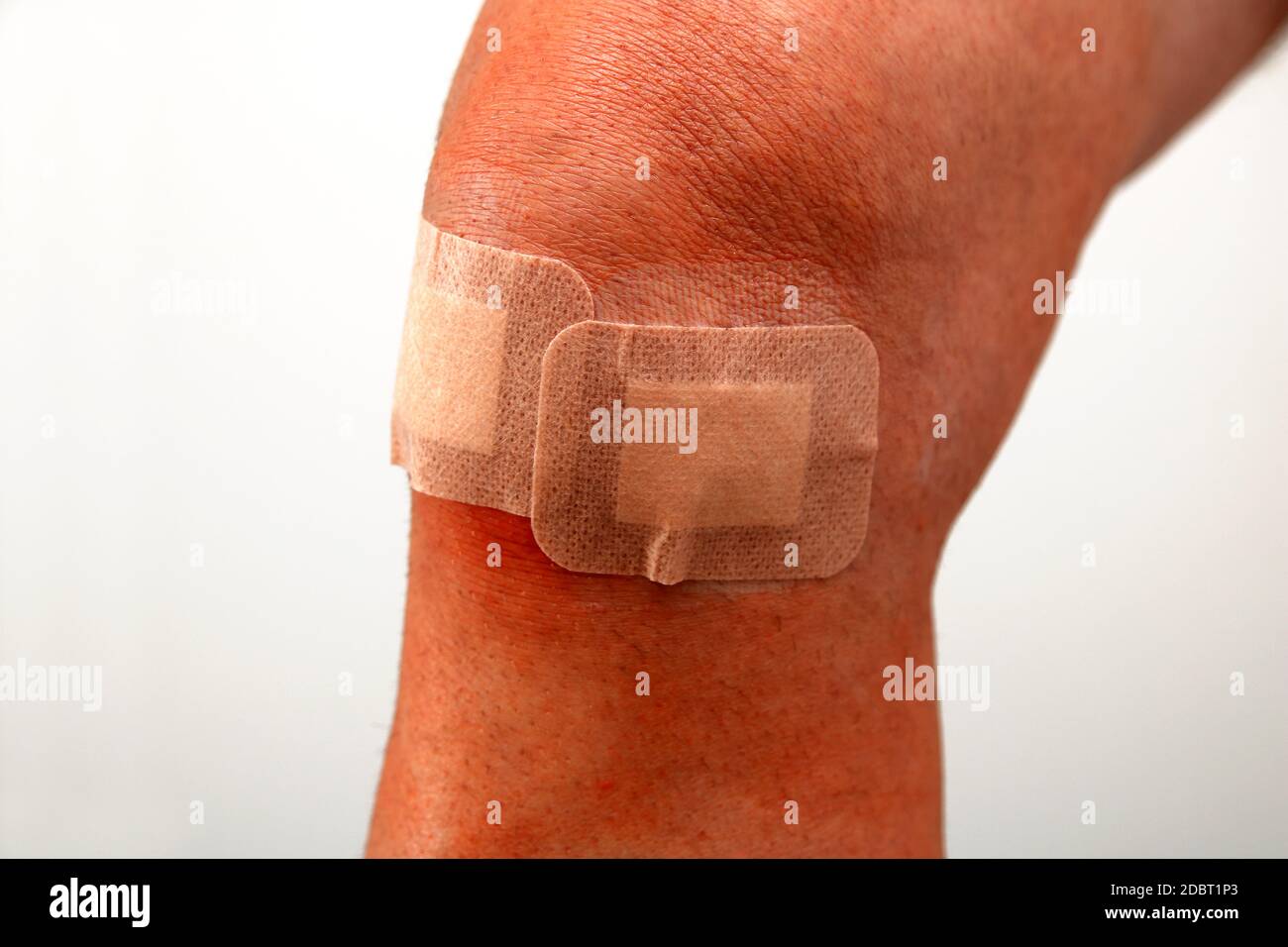 Knie meniskus hi-res stock photography and images - Alamy