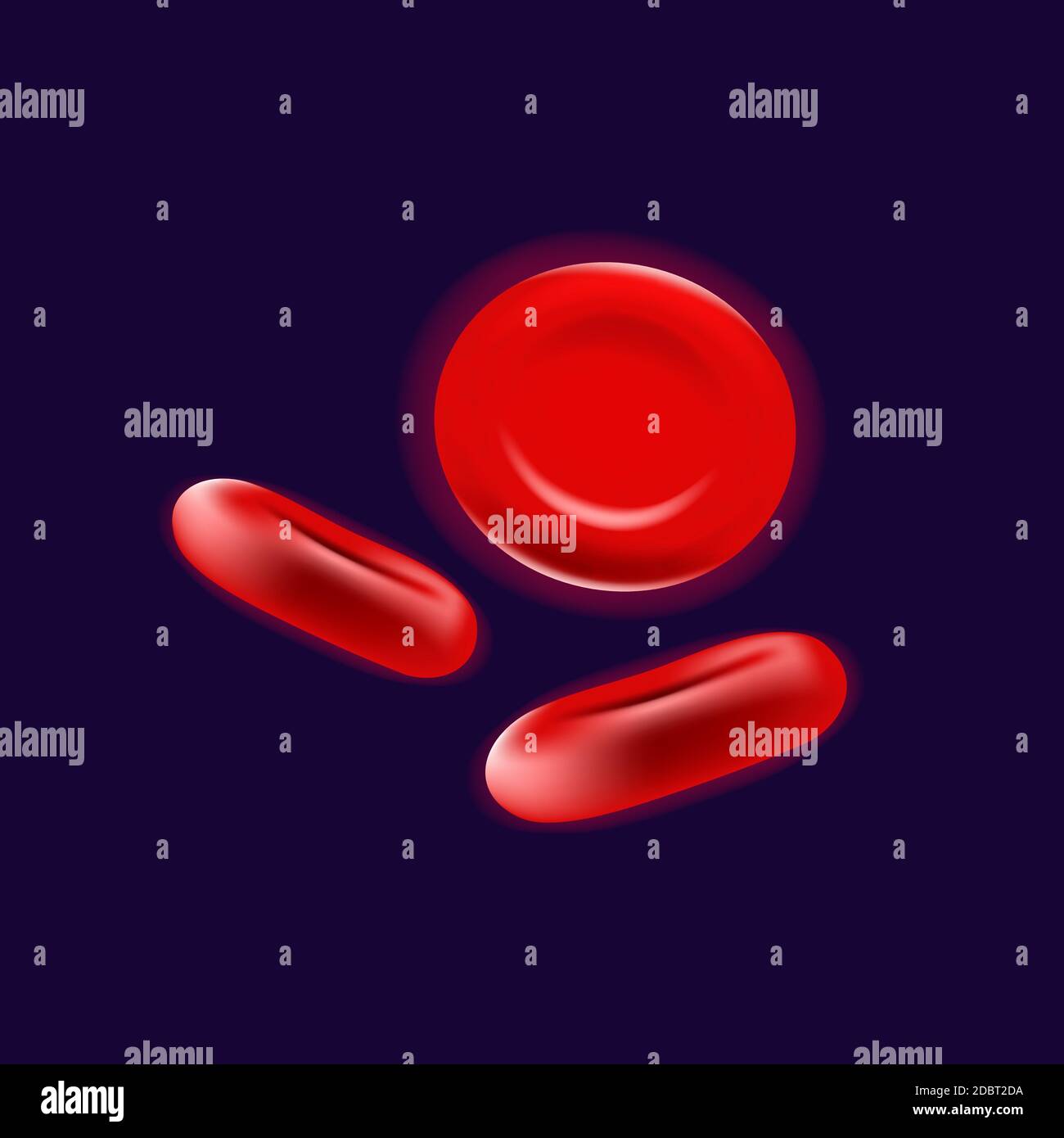 Iron deficiency anemia microscope hi-res stock photography and images ...