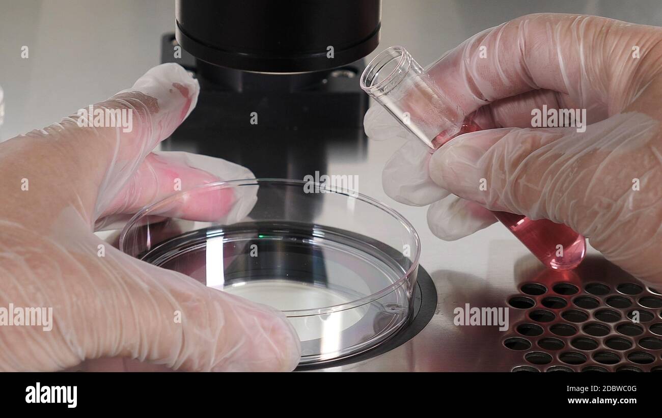 Egg collection ivf hi-res stock photography and images - Alamy