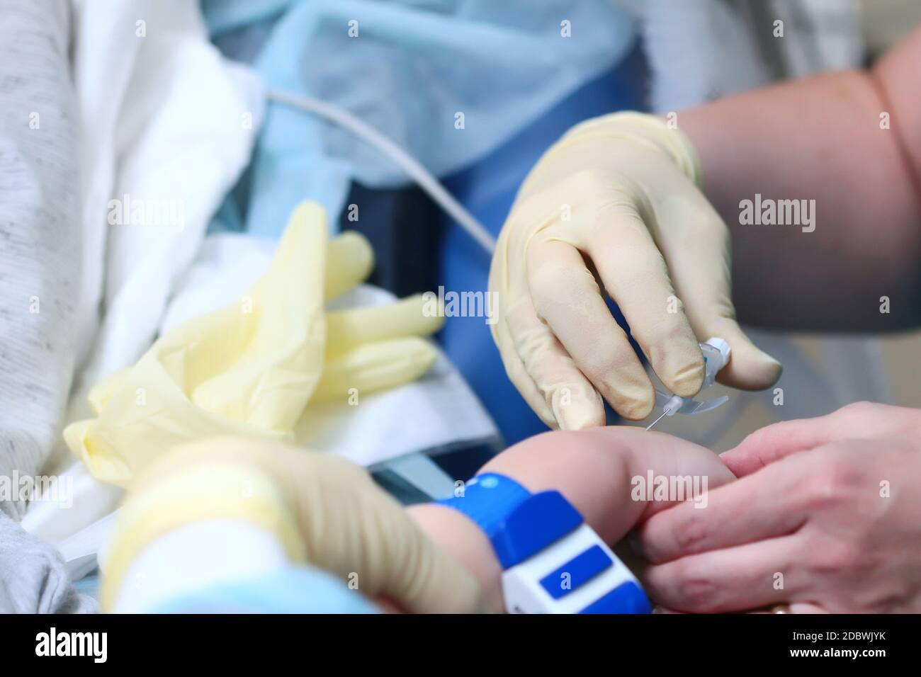 Introduction to General anesthesia of the child before surgery. The ...
