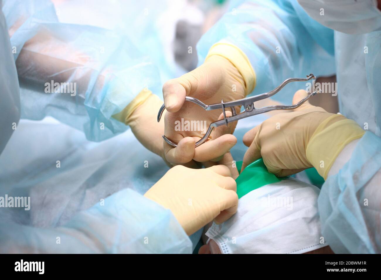 The dentist and assistant prepare the oral cavity for the removal of ...