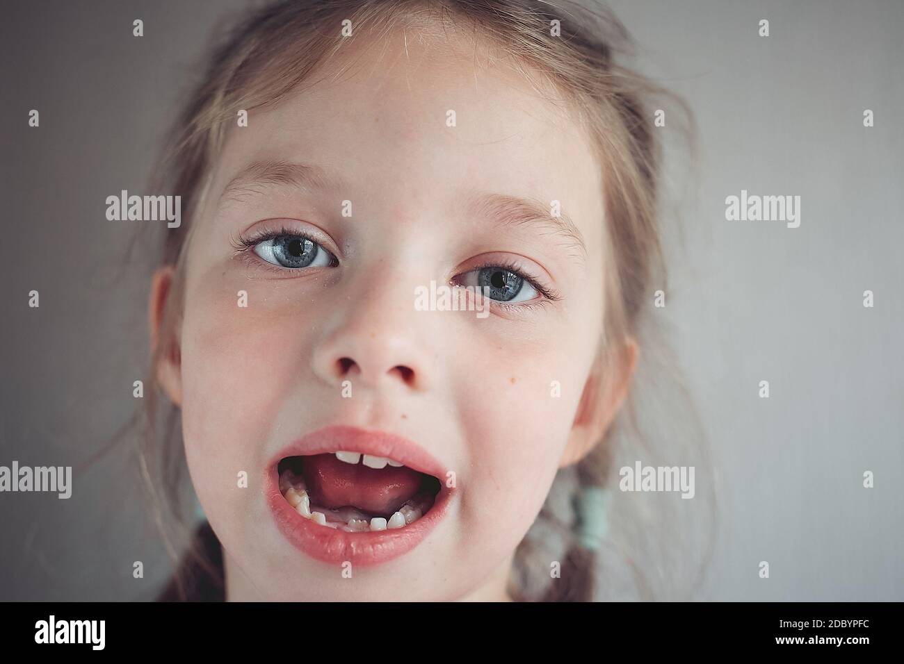 first baby teeth that fell out, portrait of a girl with her front teeth ...