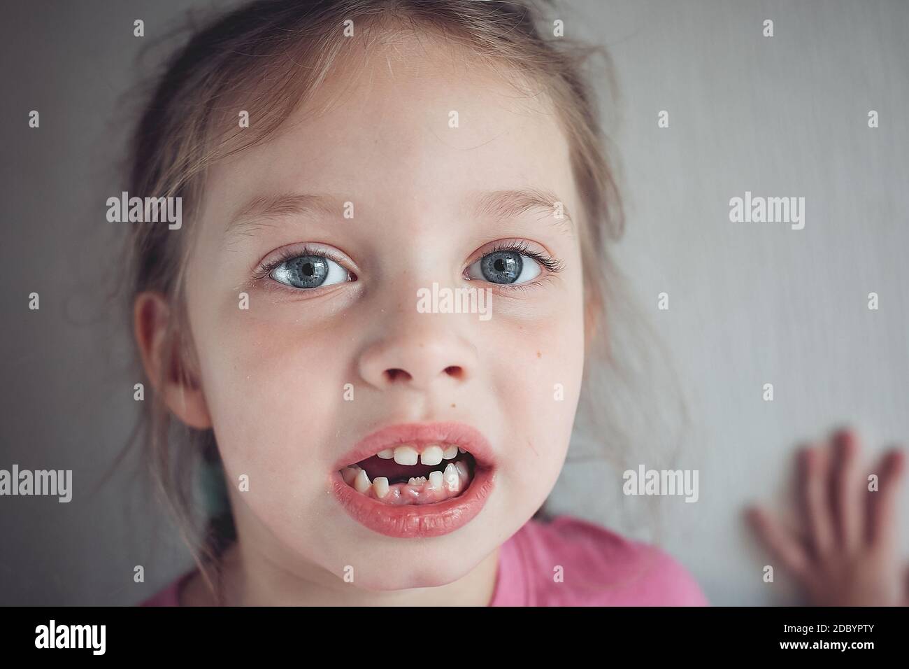 first baby teeth that fell out, portrait of a girl with her front teeth ...