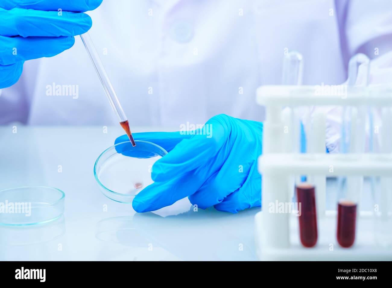 Technician scientist analyzing a blood sample on tray in laboratory for ...