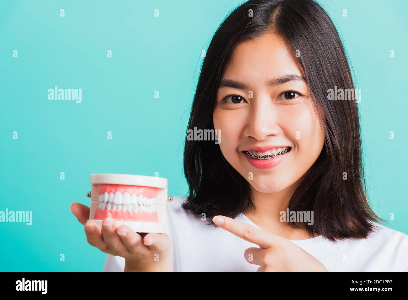 Portrait of Asian teen beautiful young woman smile have dental braces ...