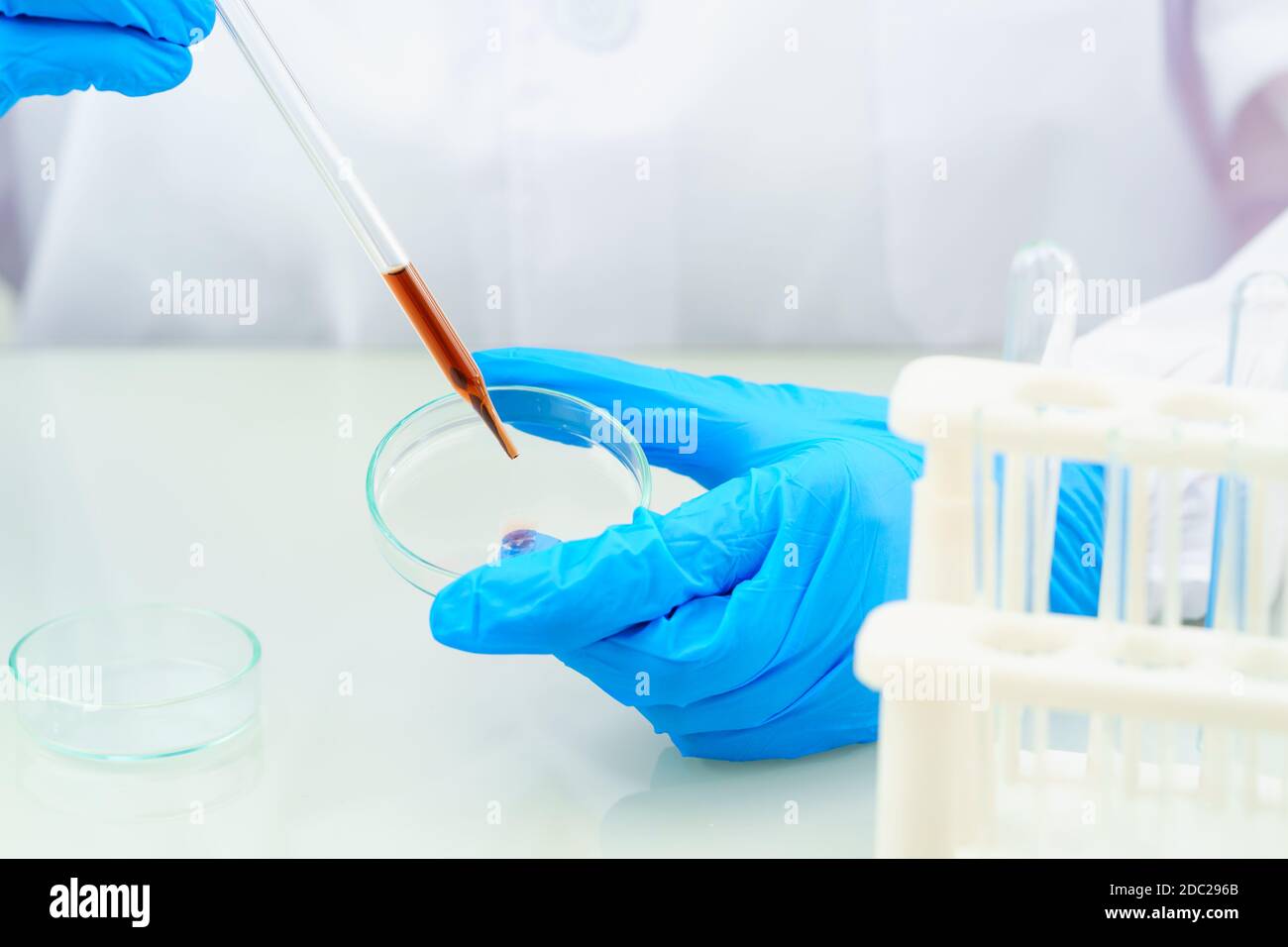 Technician scientist analyzing a blood sample on tray in laboratory for ...
