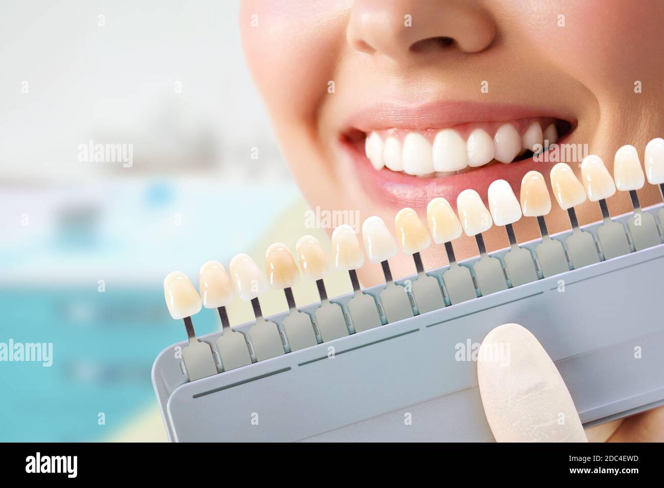 Smiling young woman. Cosmetological teeth whitening in a dental clinic ...