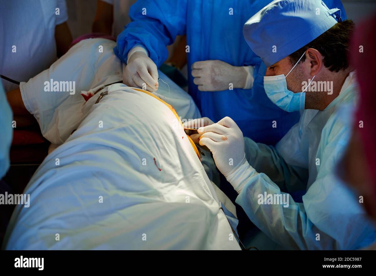 Surgery. Side view of surgeon stitching a wound using a surgical ...
